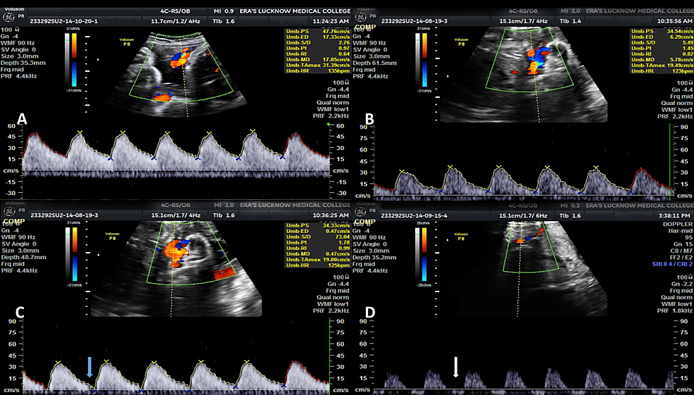 بهترین کیلینک سونوگرافی داپلر رشد جنین یا IUGR